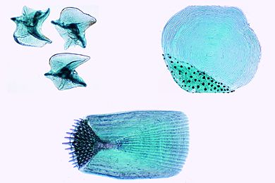 Mikropräparat Fischschuppen-Typen. Cycloid-, Placoid-und Ctenoidschuppen
